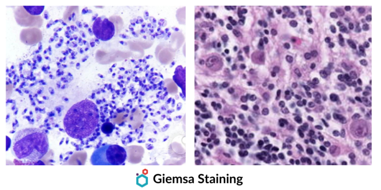 Giemsa Stain | Composition, Principle, Procedure & Uses